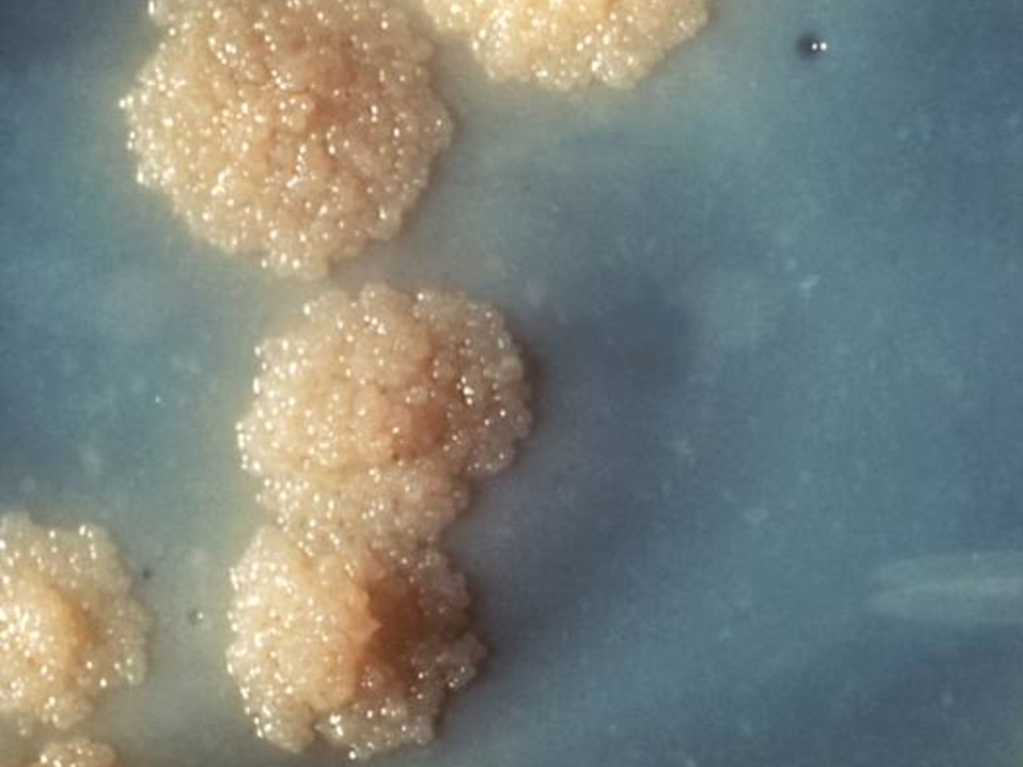 NIH Awards Alissa Rothchild with $2.2 Million to Explore New ...