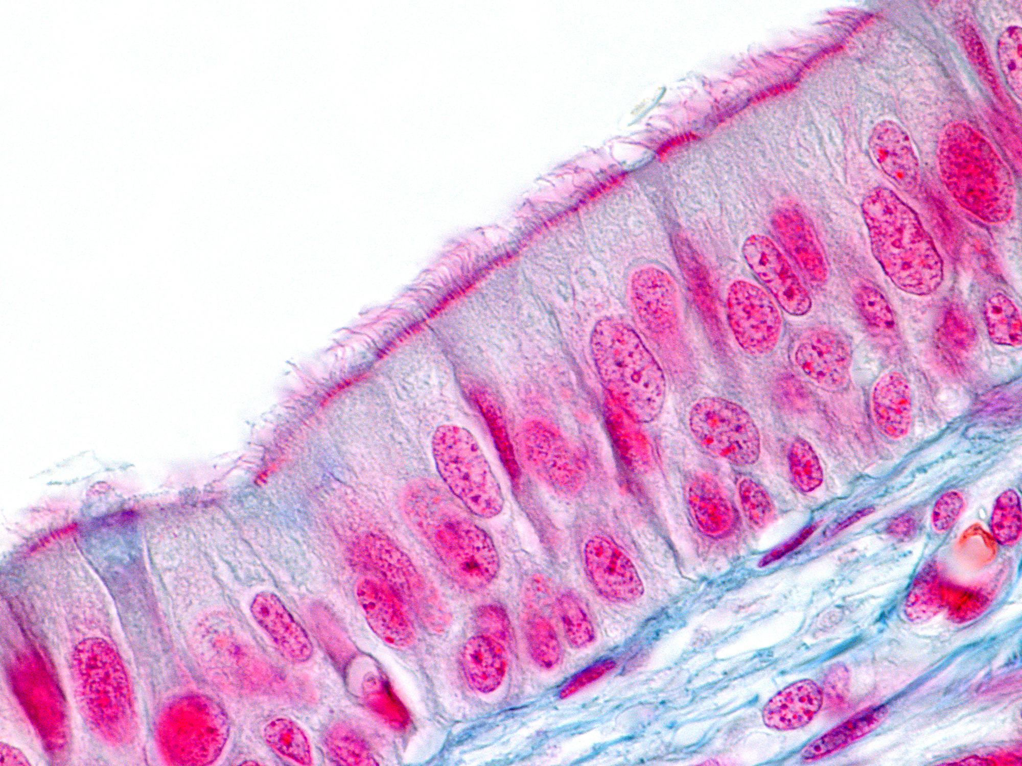 PSE Team First to Detect Silent 'Scream' of Epithelial Cells : College ...